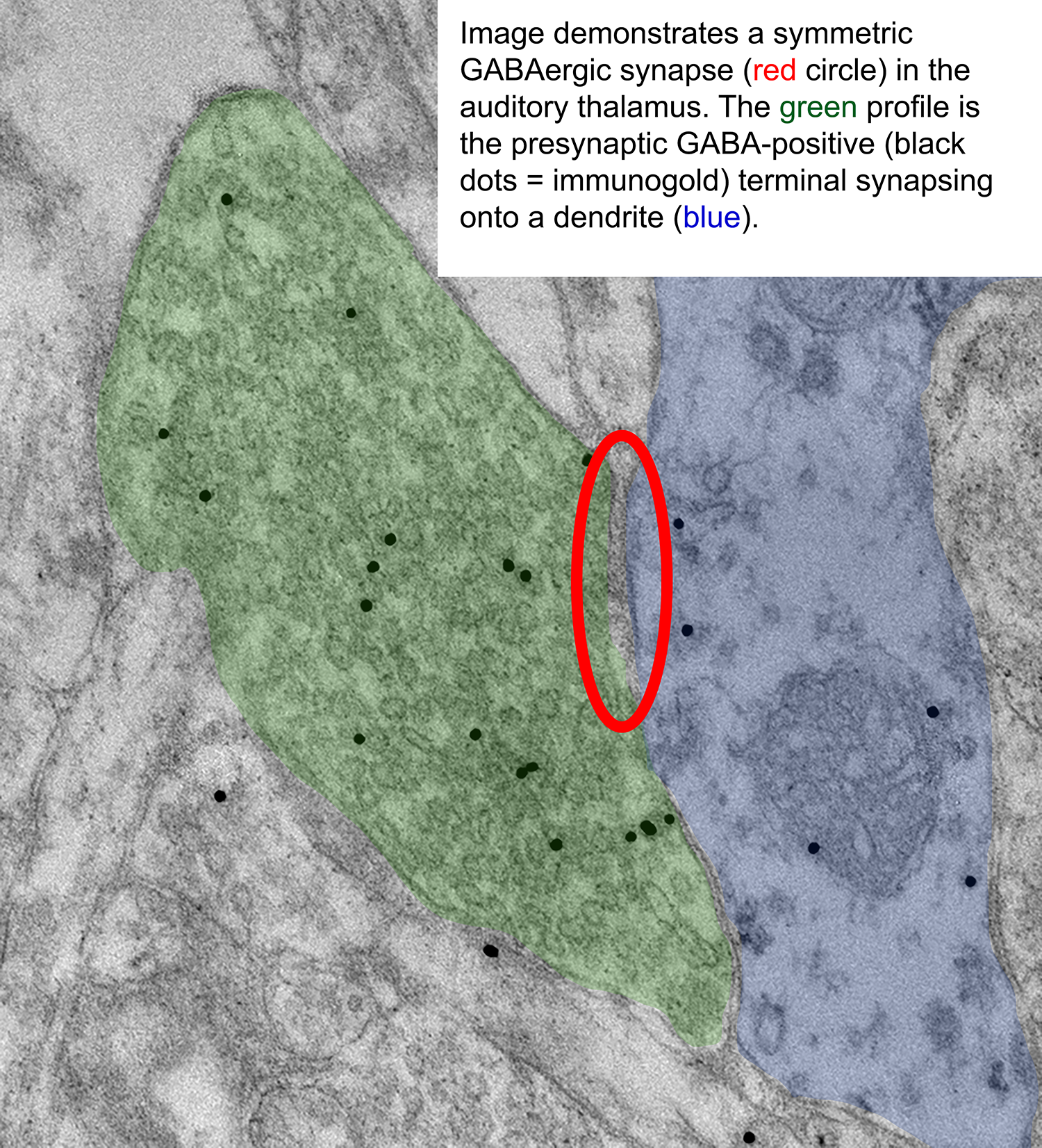 Auditory Thalamus Synaptic Changes : The University of Akron, Ohio
